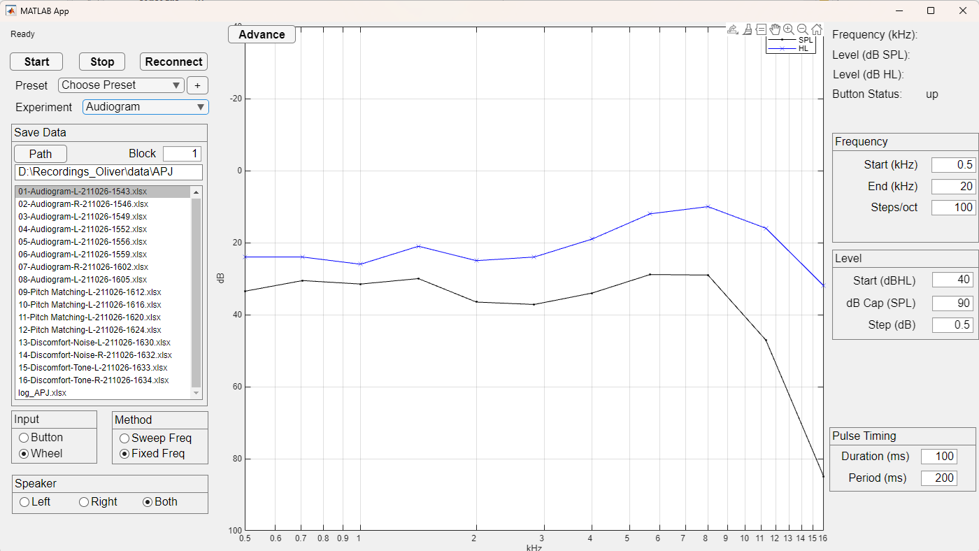 Tinnitus study | Christopher M Lee