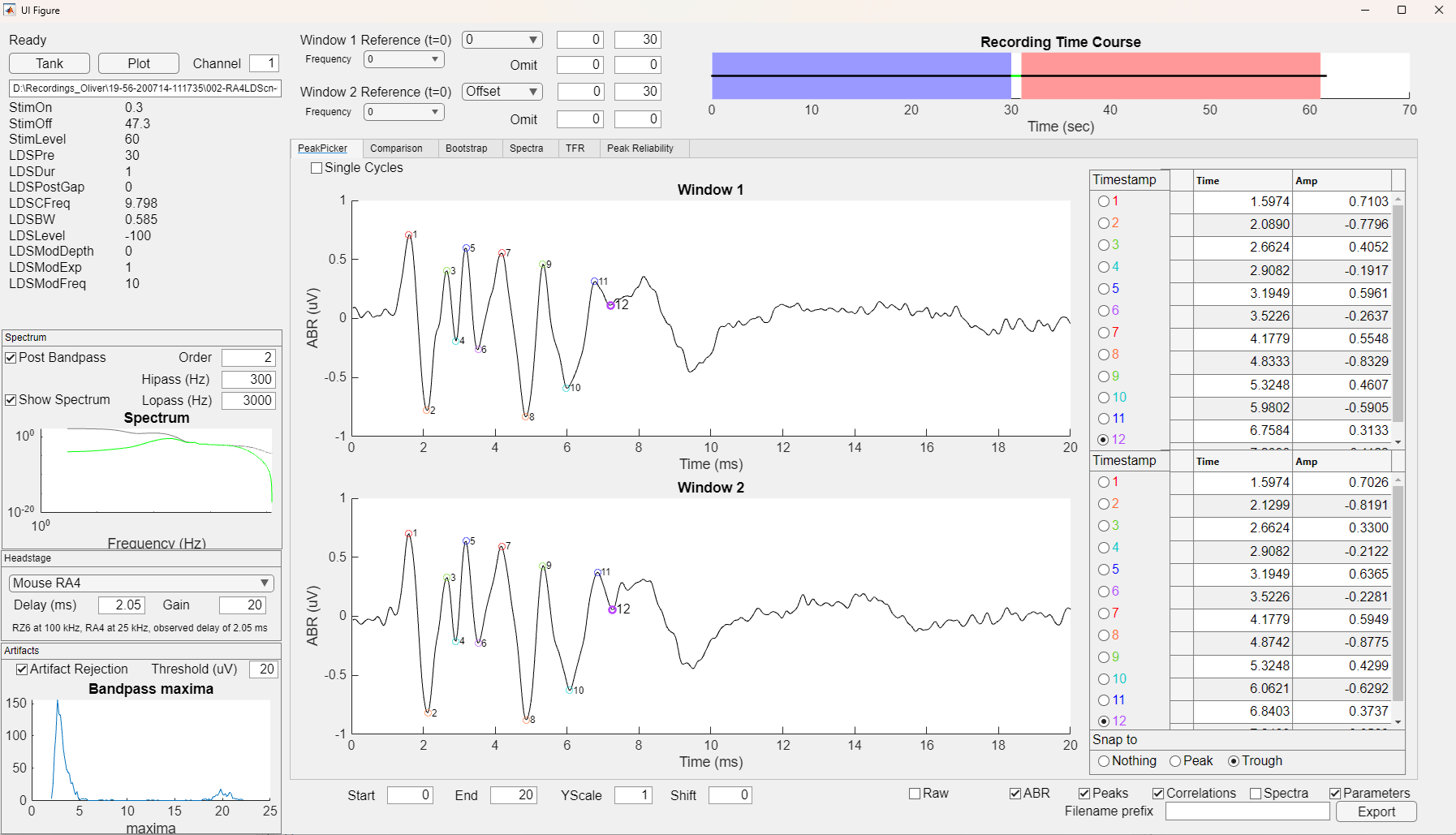 Tinnitus study | Christopher M Lee